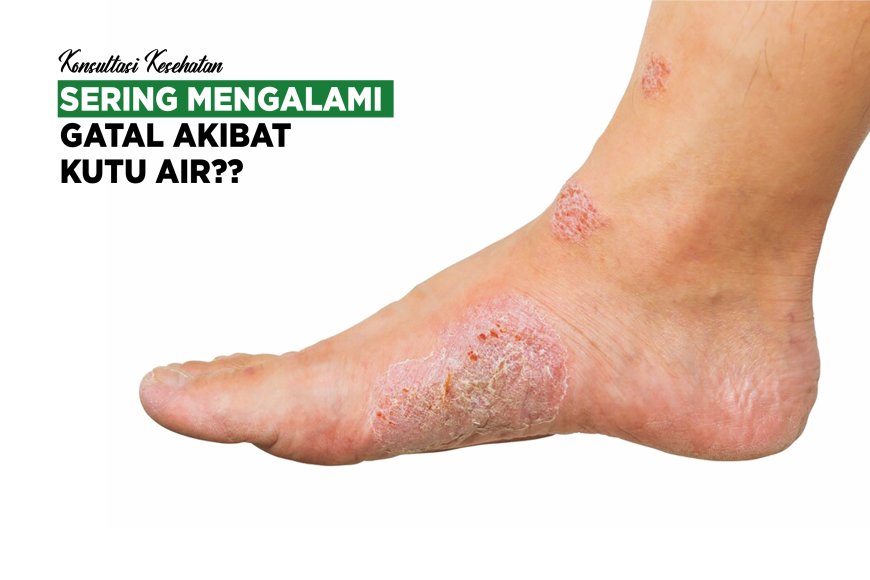 SERING MENGALAMI GATAL AKIBAT KUTU AIR - LAZ Sidogiri